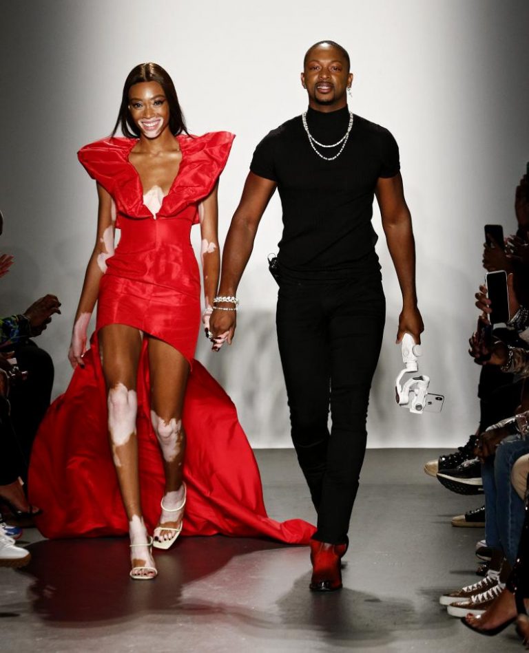 Modelo con vitiligo será parte del famoso desfile de Victoria's Secret