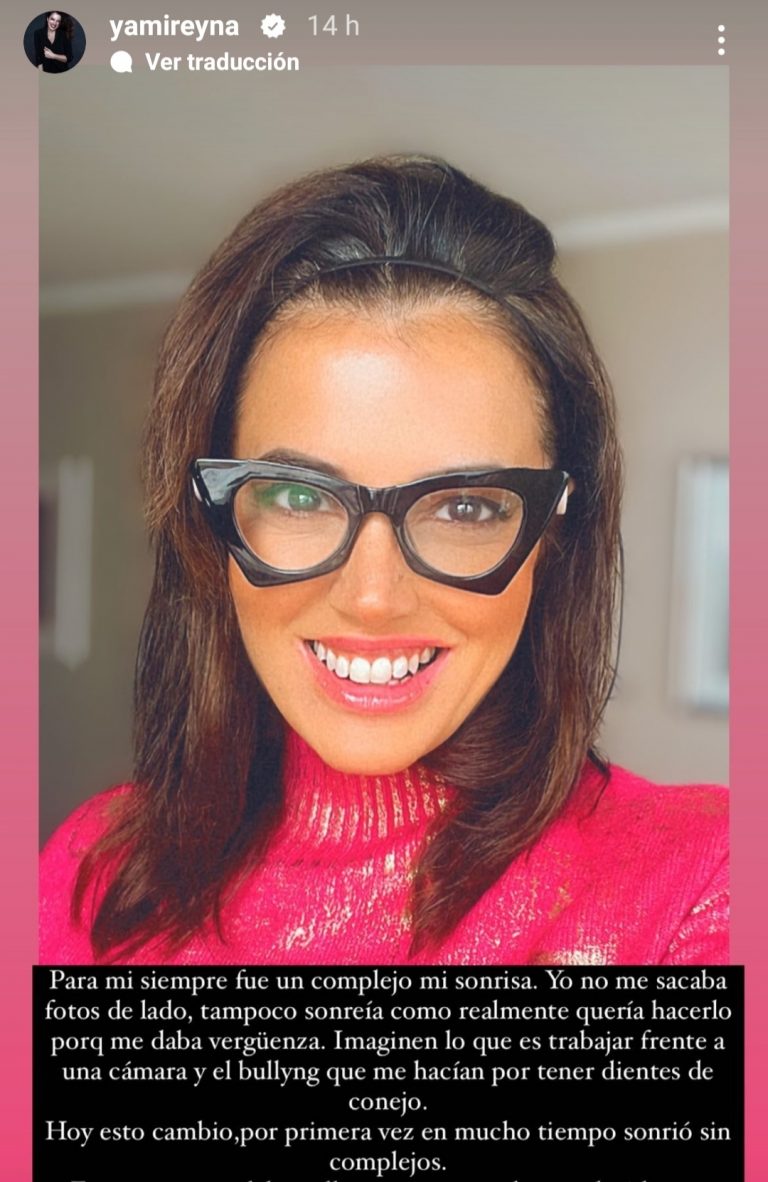 Yamila Reyna se despidió de los brackets y estrenó nueva sonrisa