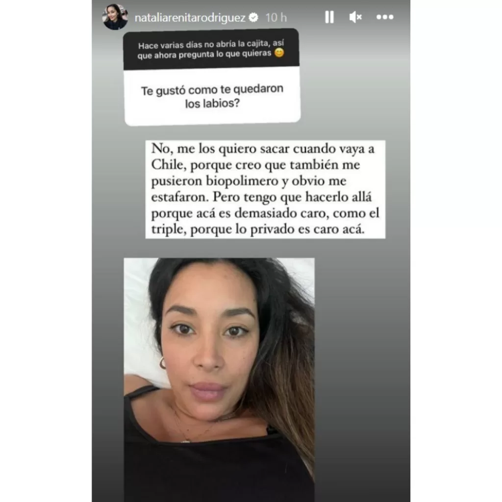 "Me estafaron": Natalia Rodríguez comparte grave queja tras someterse a procedimiento estético